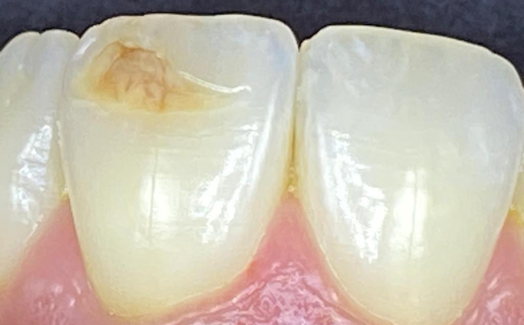 It’s time to chalk and talk! | iSmile Studio